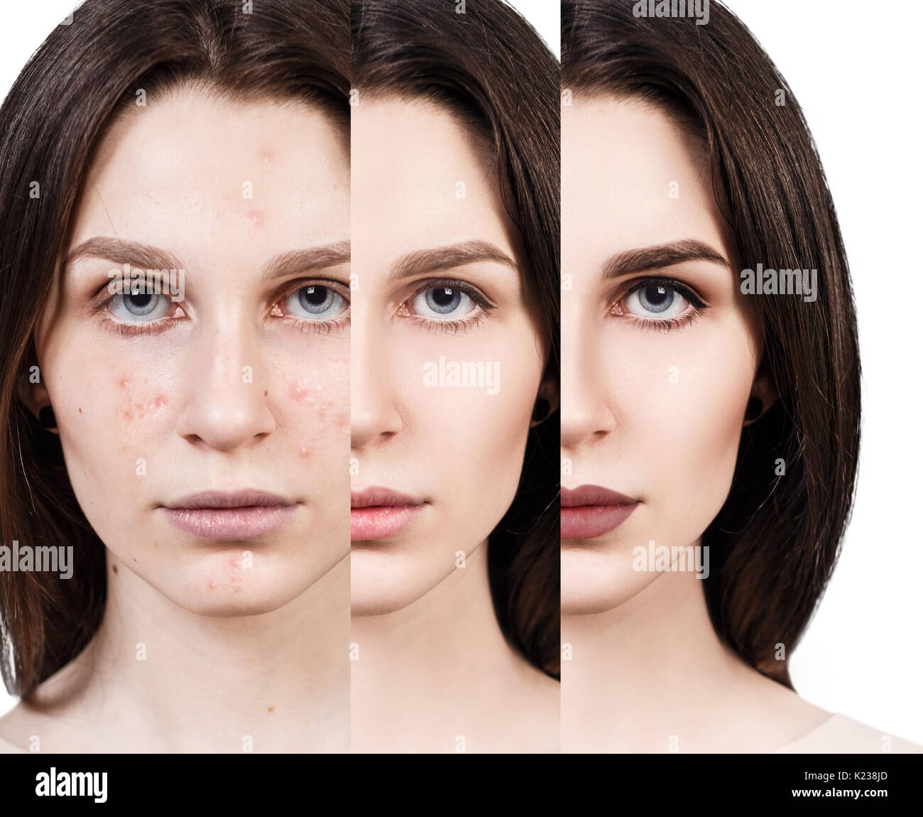 Flecken vor den augen -Fotos und -Bildmaterial in hoher Auflösung – Alamy
