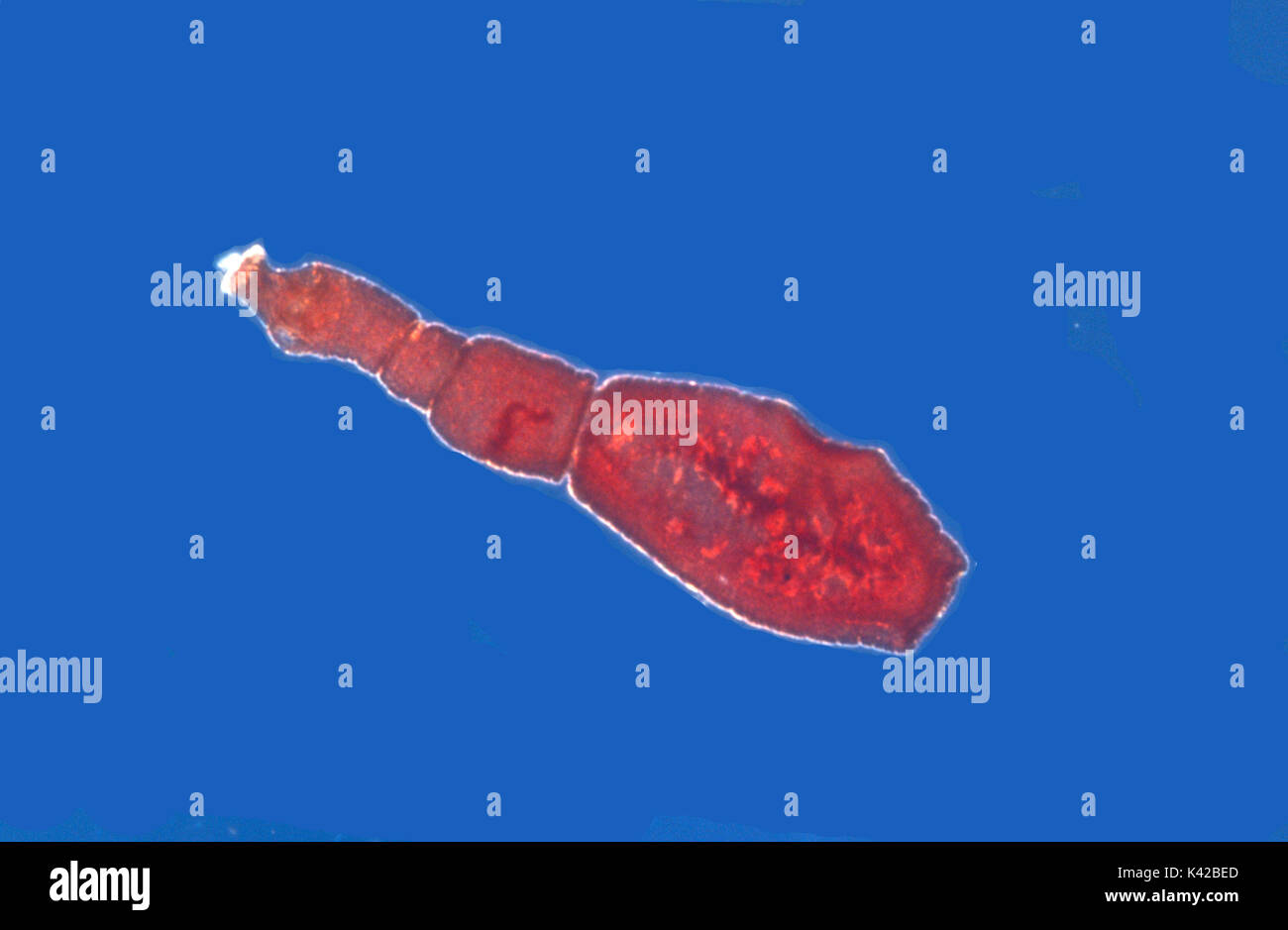 Bandwurm, Echinococcas sp. Parasiten, mikroskopisch kleinen, blauen ...