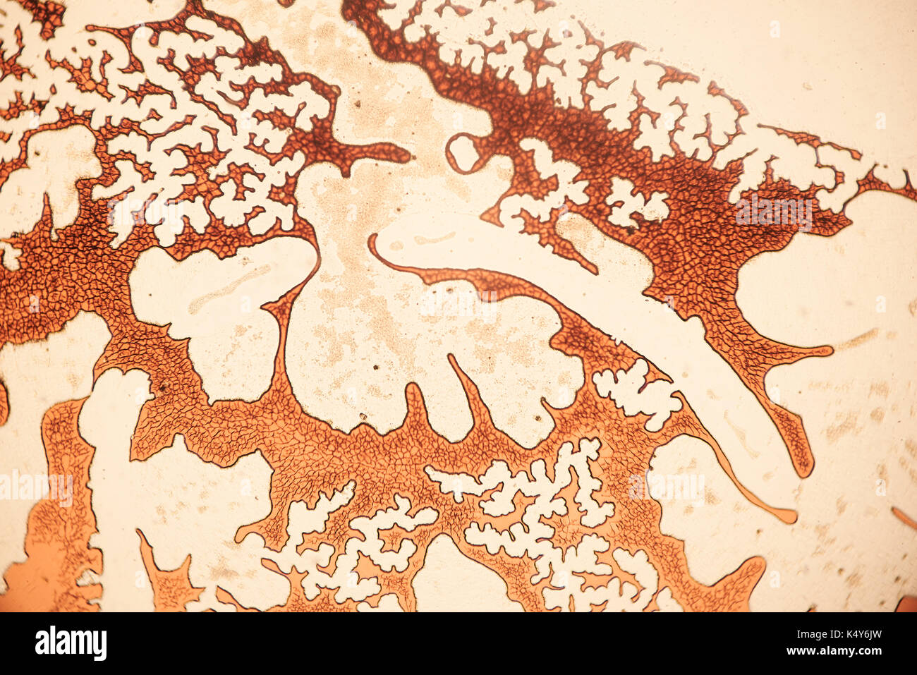 Menschliches lungengewebe -Fotos und -Bildmaterial in hoher Auflösung ...