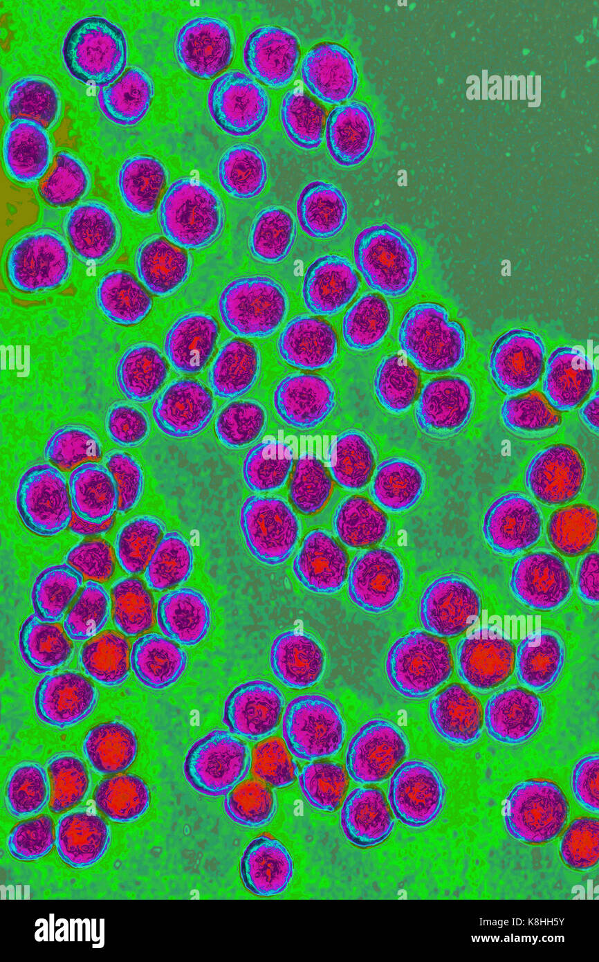 Staphylokokken infektion -Fotos und -Bildmaterial in hoher Auflösung ...