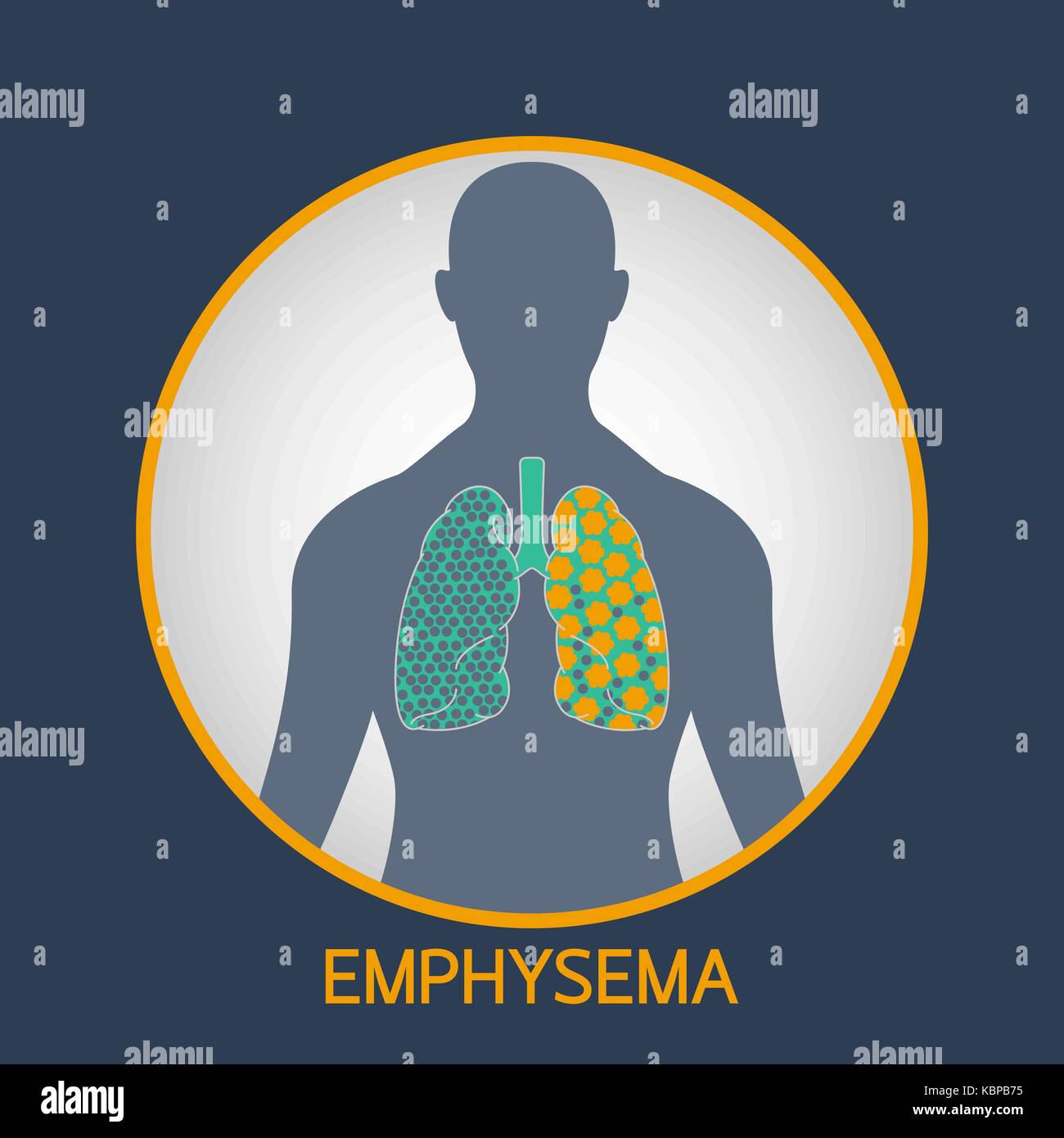 Emphysem Vektor logo Symbol Abbildung Stock-Vektorgrafik - Alamy