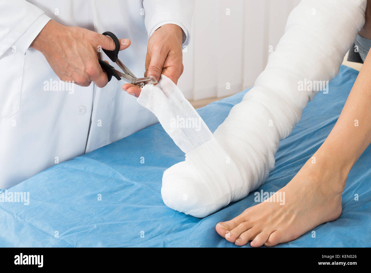 Bein Gips Stockfotos & Bein Gips Bilder - Alamy