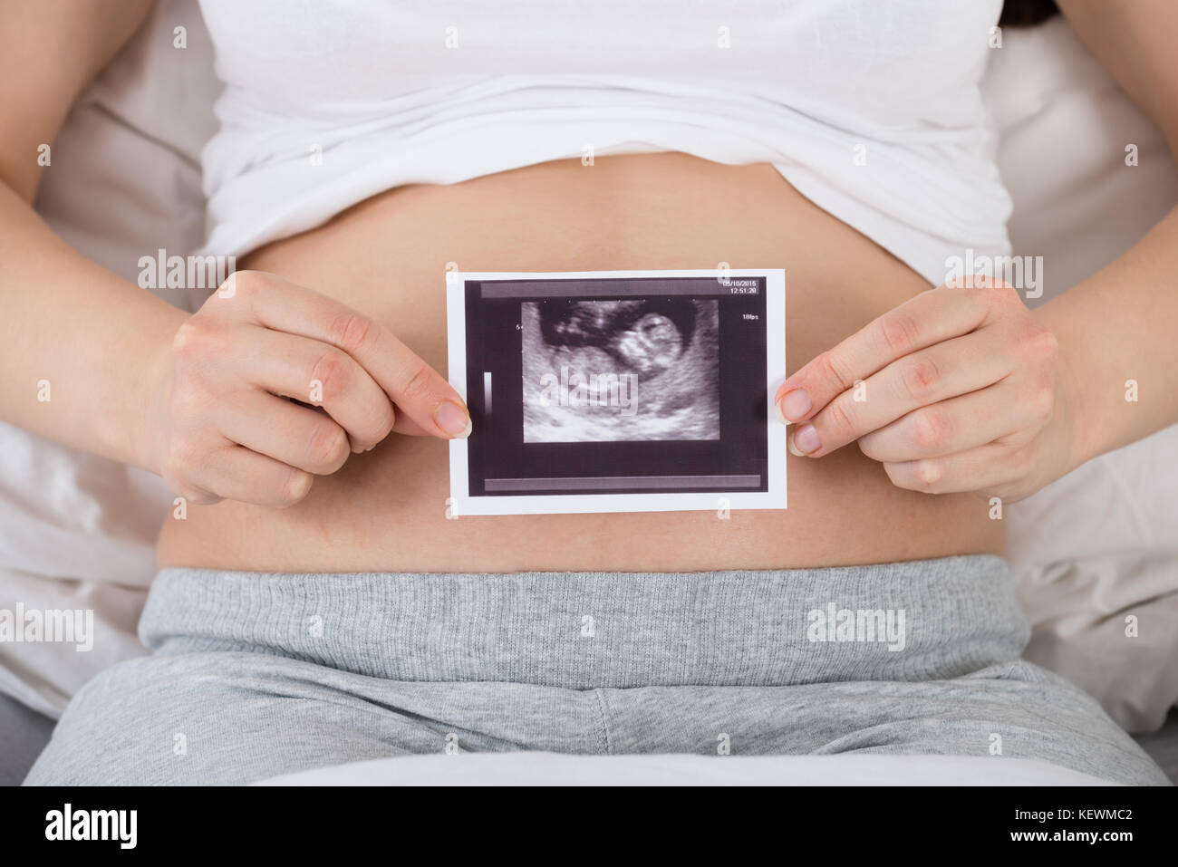 Ultraschall baby bild -Fotos und -Bildmaterial in hoher Auflösung – Alamy