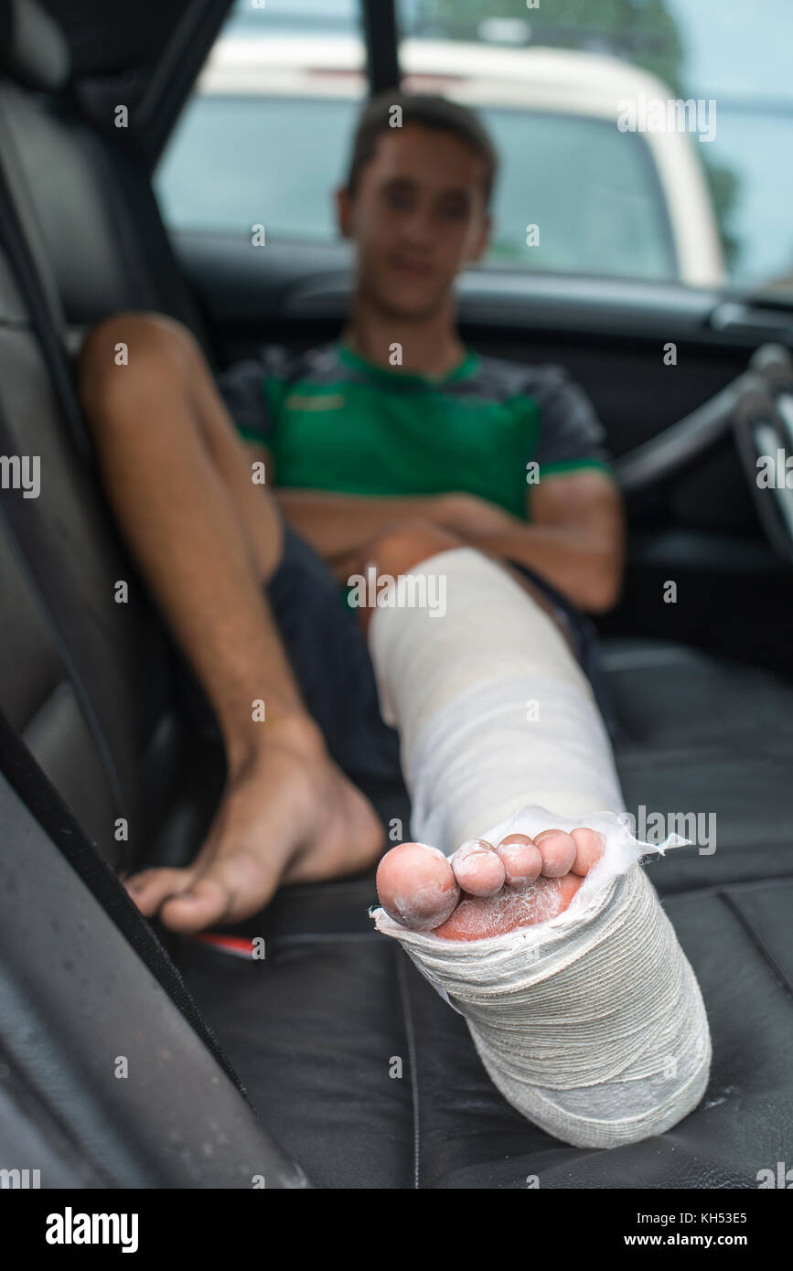 Junge haben sich das Bein gebrochen. Gips Fuß Stockfotografie - Alamy