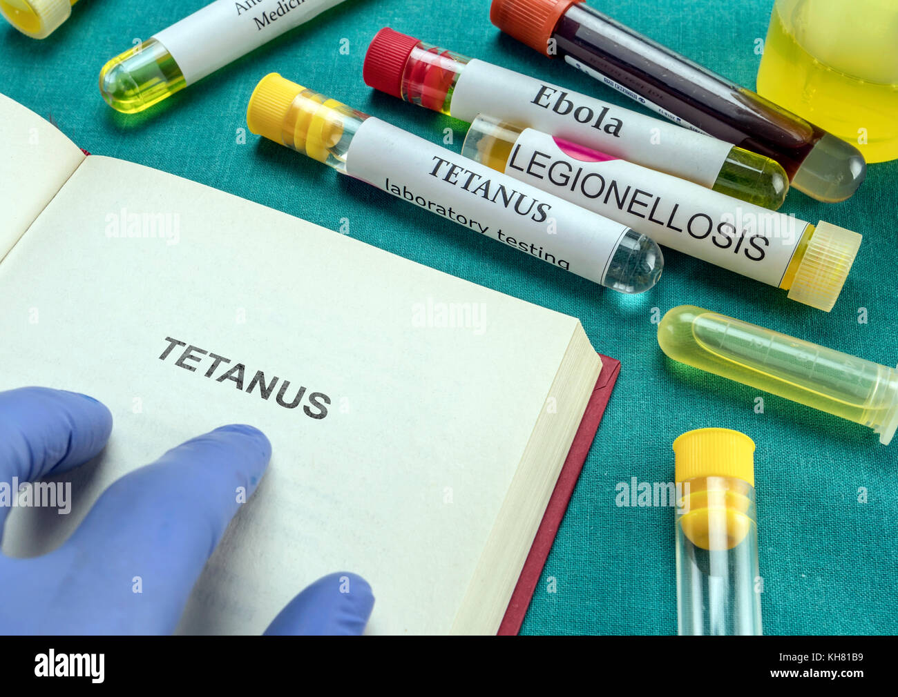 Tetanus infection -Fotos und -Bildmaterial in hoher Auflösung – Alamy