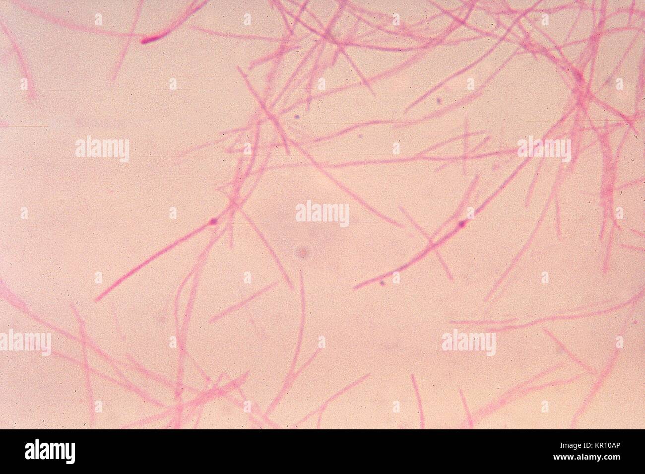 Diese Aufnahme zeigt das Gram-negative Bakterium, Fusobacterium ...