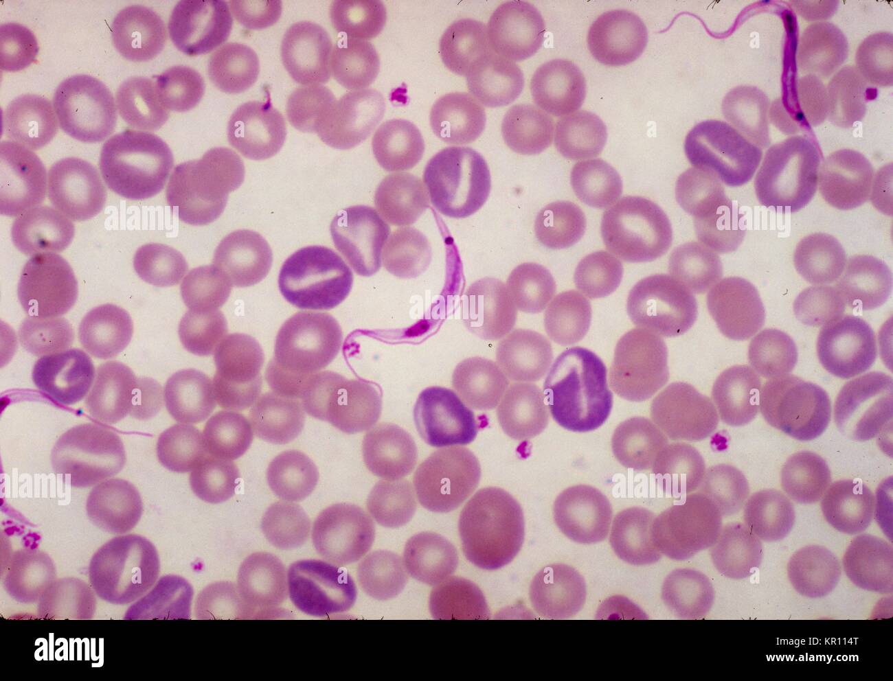 Dies ist ein schliffbild einer Ratte Blut enthüllen dem Namen ...