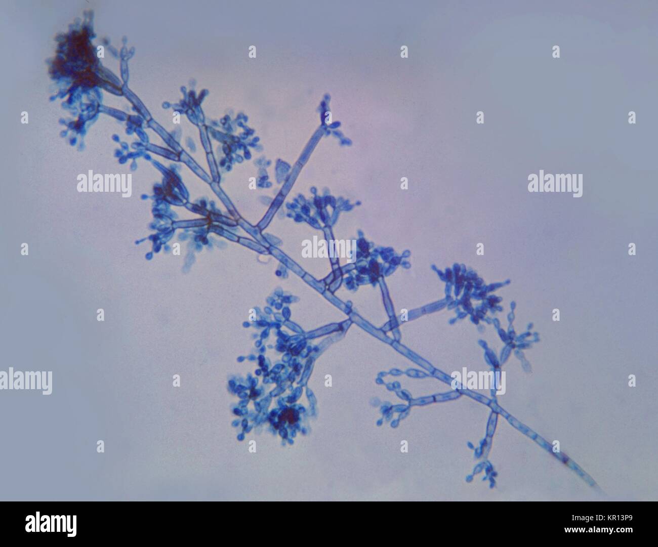 Dies ist ein photomicrograph des dematiaceous, oder dunkle Pilze ...