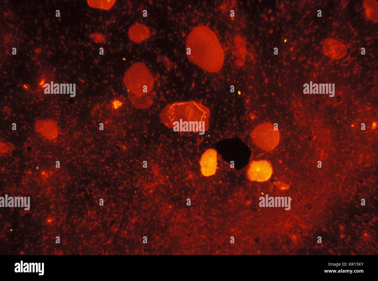 Microscopia fluorescente bacterias -Fotos und -Bildmaterial in hoher ...