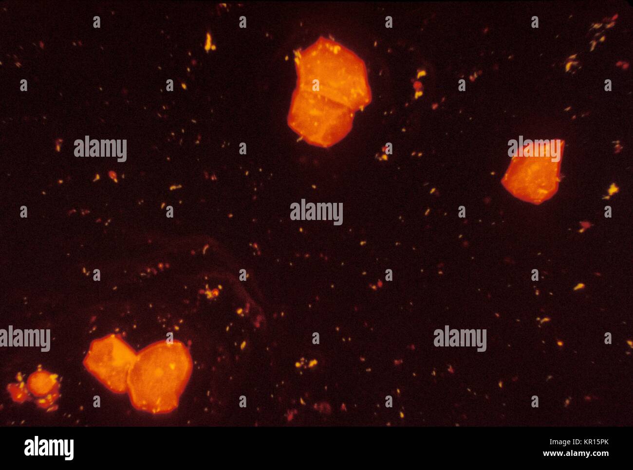 Microscopia fluorescente bacterias -Fotos und -Bildmaterial in hoher ...
