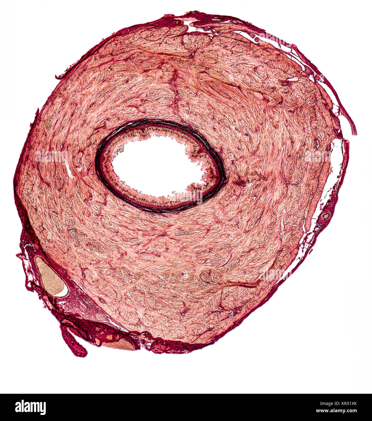 Vas deferens -Fotos und -Bildmaterial in hoher Auflösung – Alamy
