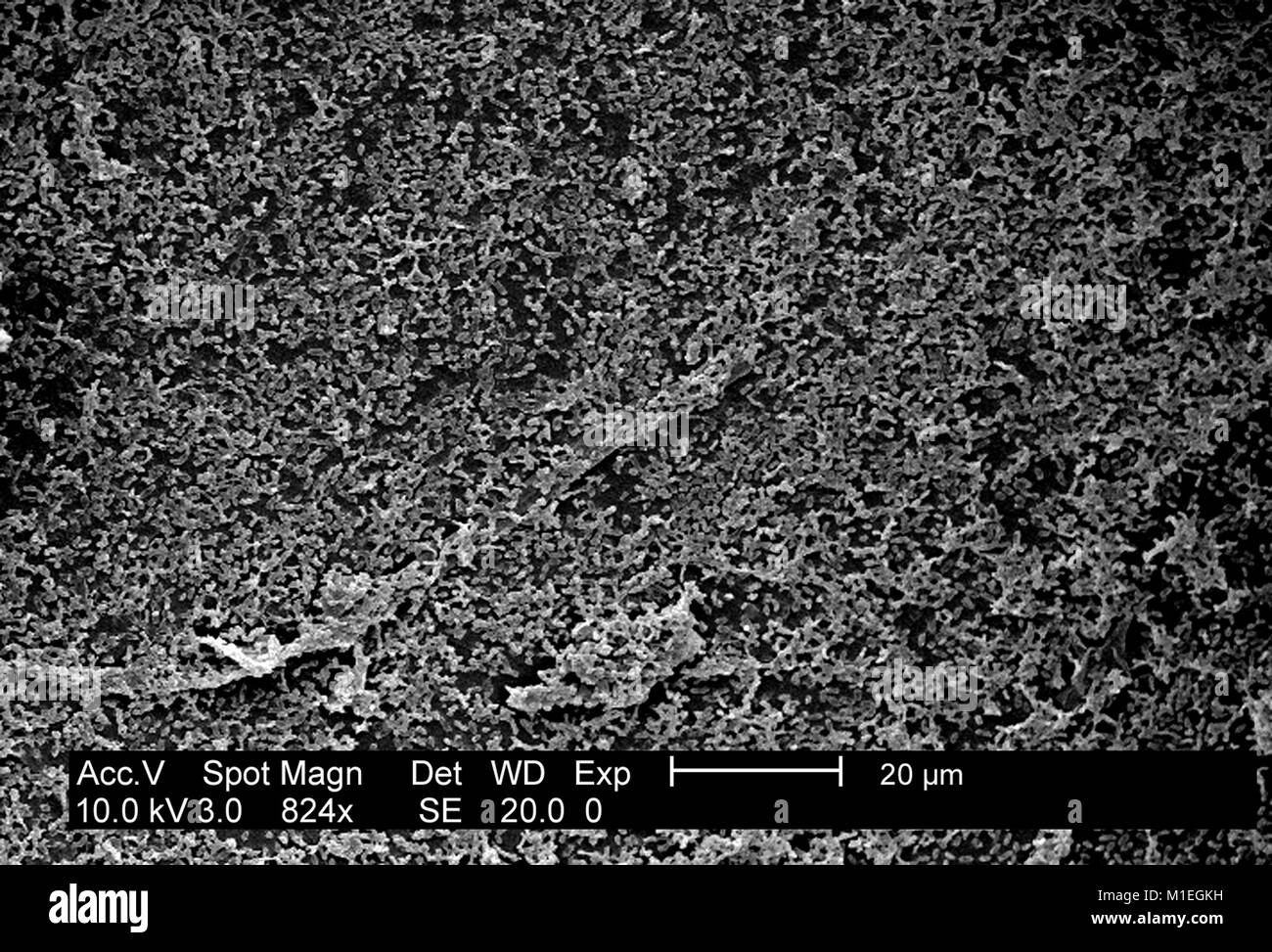 Image courtesy cdc -Fotos und -Bildmaterial in hoher Auflösung – Alamy