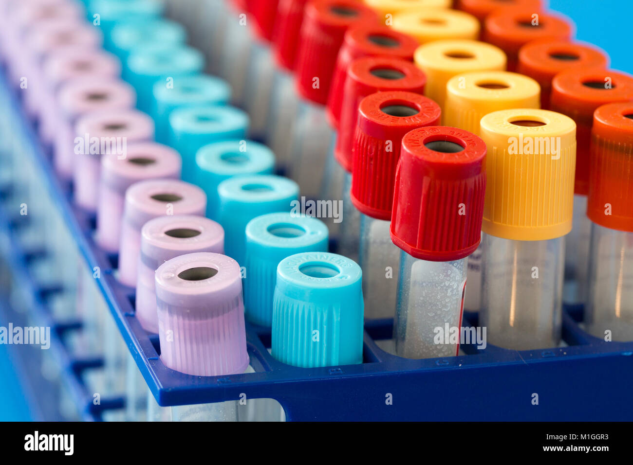 Blutserum röhrchen -Fotos und -Bildmaterial in hoher Auflösung – Alamy