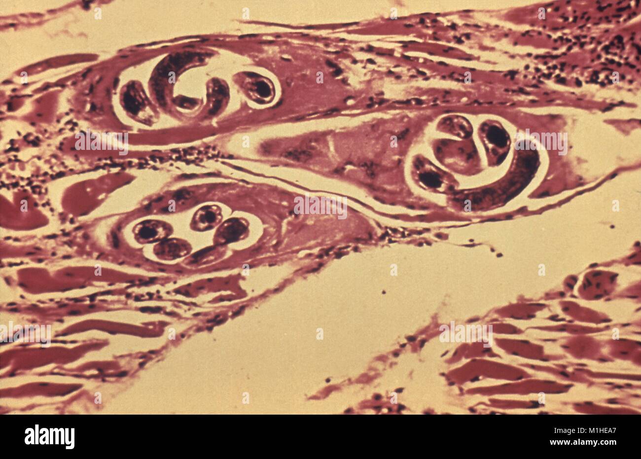 Trichinella zyste -Fotos und -Bildmaterial in hoher Auflösung – Alamy