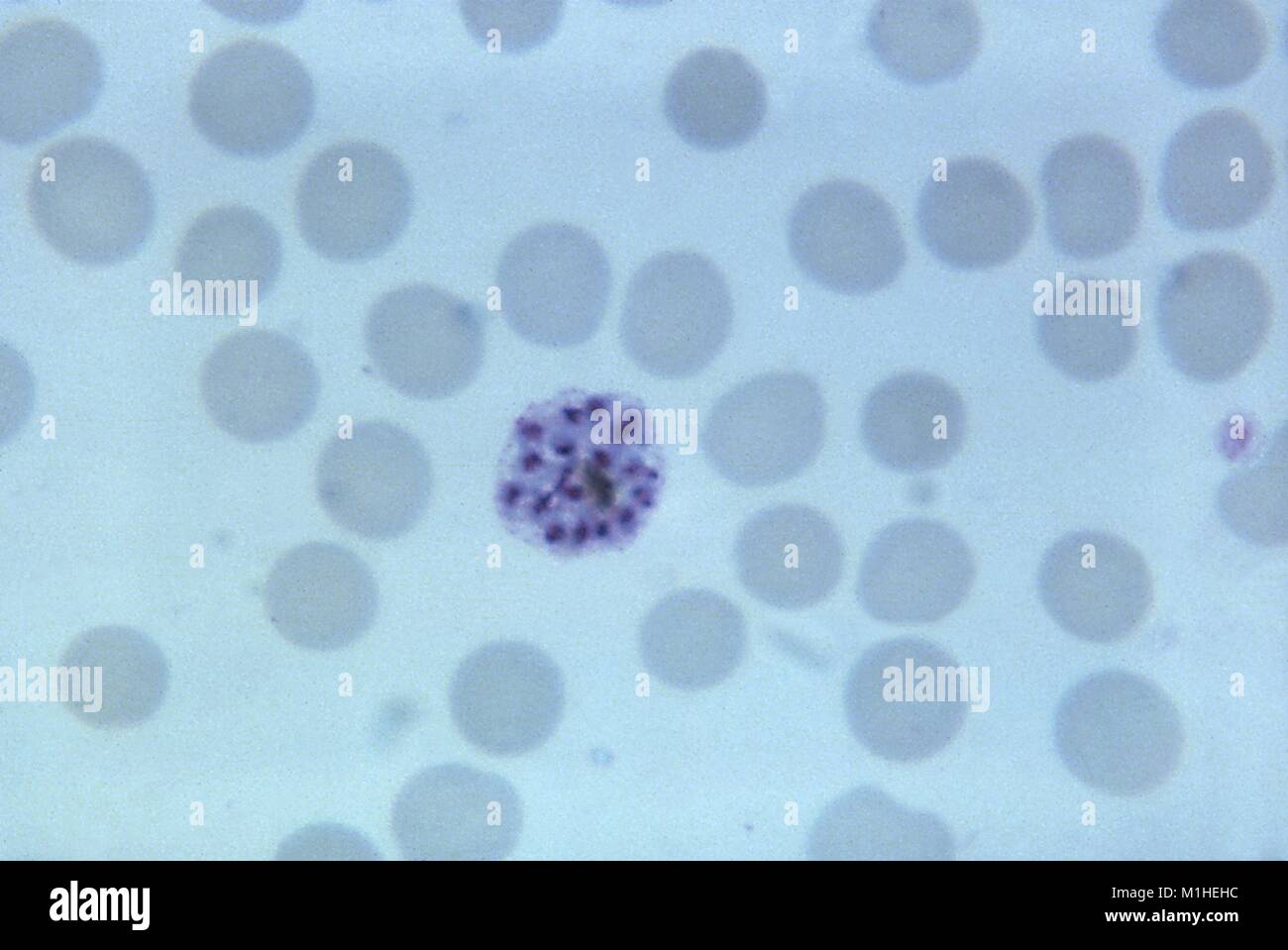 Photomicrograph des Malariaparasiten Plasmodium vivax in seiner reifen ...
