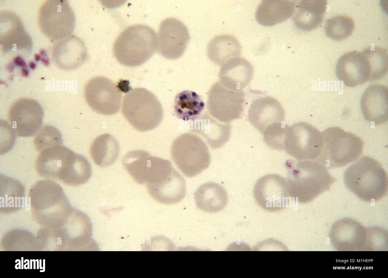 Malaria merozoiten -Fotos und -Bildmaterial in hoher Auflösung – Alamy