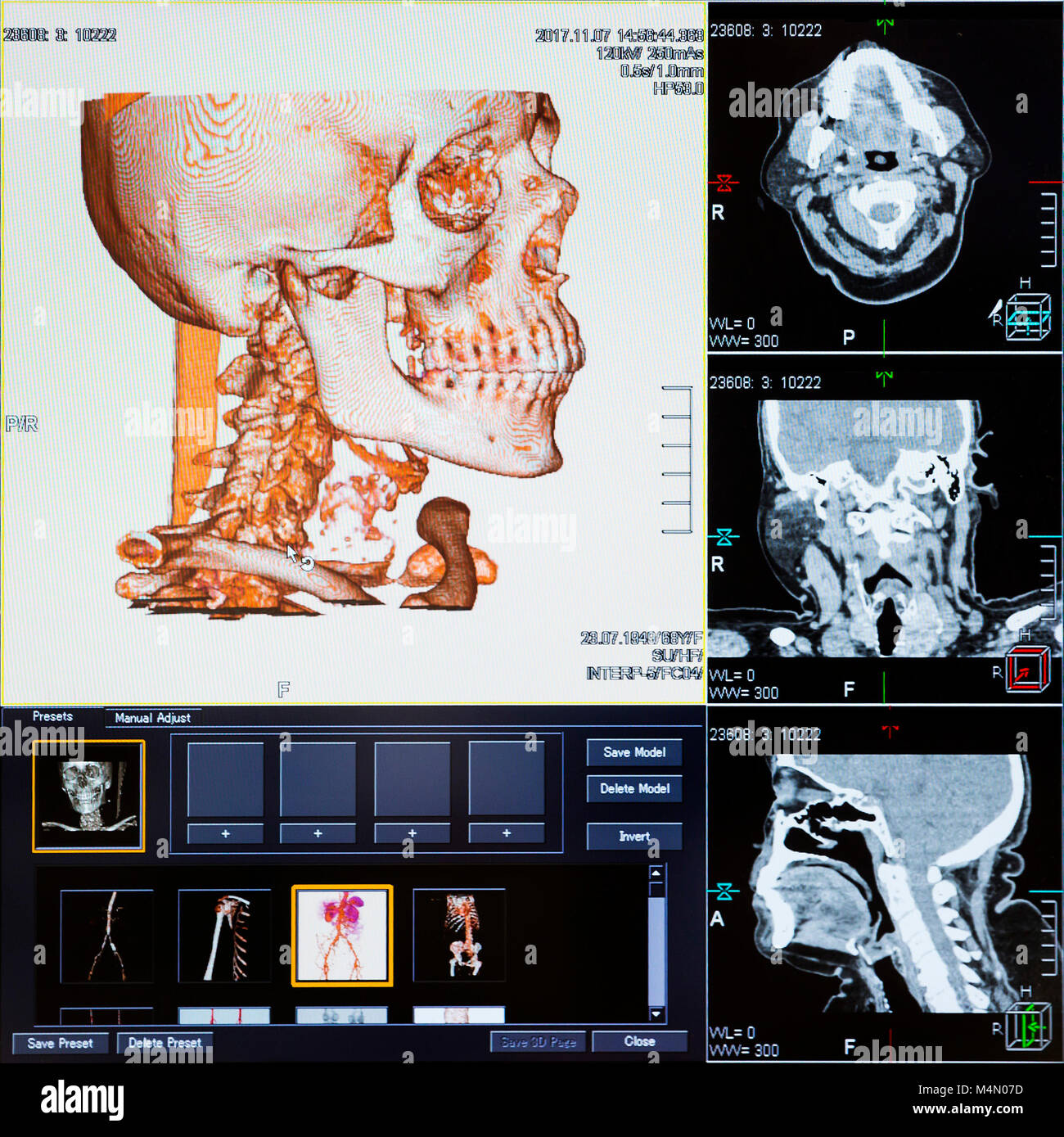 Ct scan gehirn gesund -Fotos und -Bildmaterial in hoher Auflösung - Seite 2 - Alamy