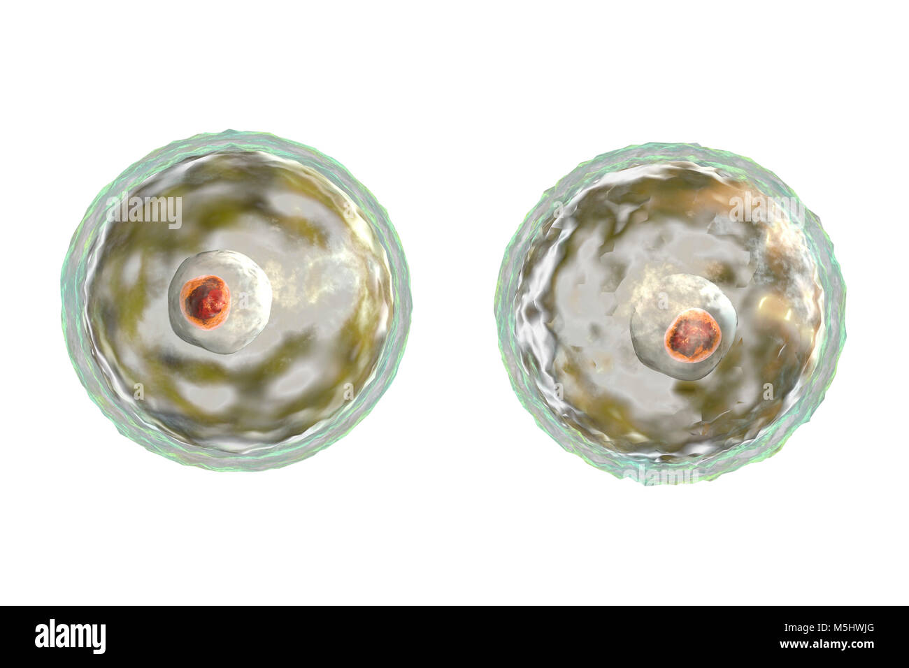 Zyste Im Gehirn Stockfotos und -bilder Kaufen - Alamy