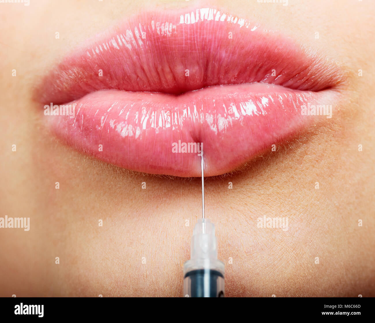 Botox Der Lippen Stockfotos und -bilder Kaufen - Alamy