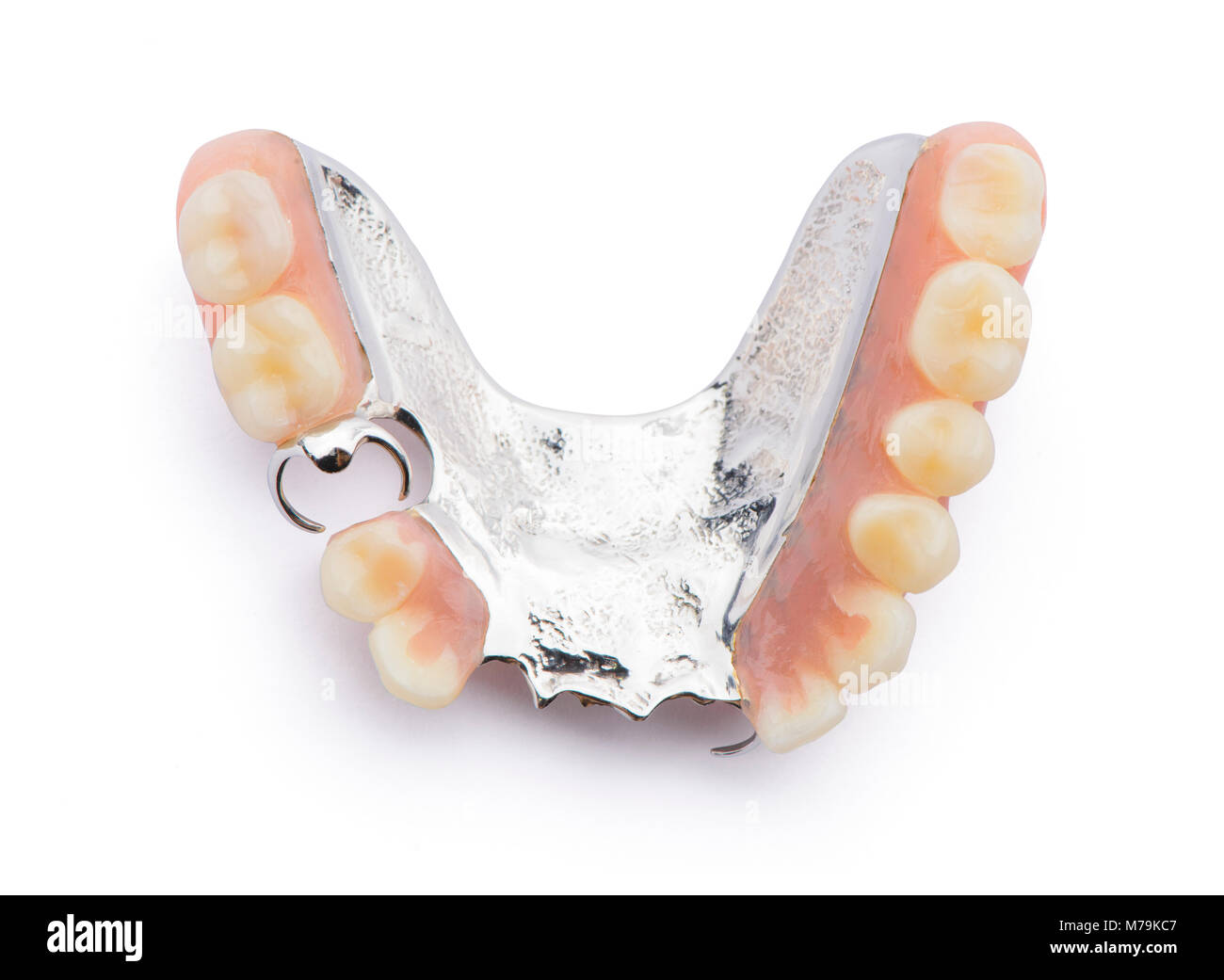 Herausnehmbare teilprothese -Fotos und -Bildmaterial in hoher Auflösung ...