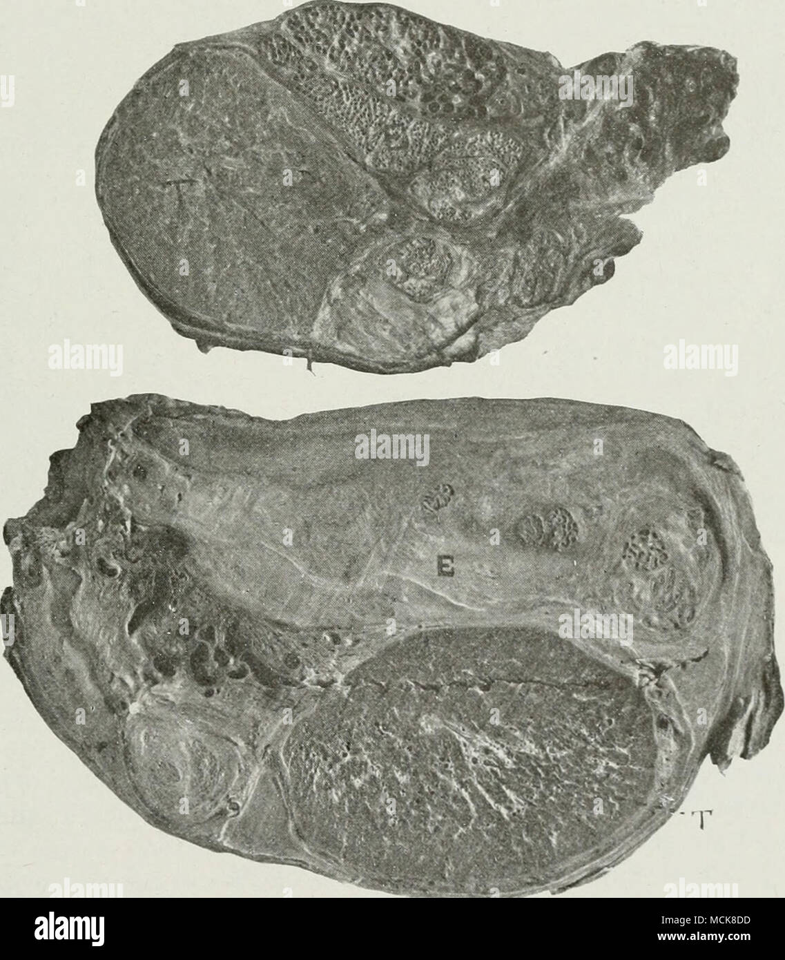 Nebenhoden orchitis -Fotos und -Bildmaterial in hoher Auflösung – Alamy