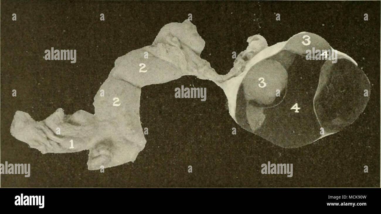 Follikuläre zyste -Fotos und -Bildmaterial in hoher Auflösung – Alamy