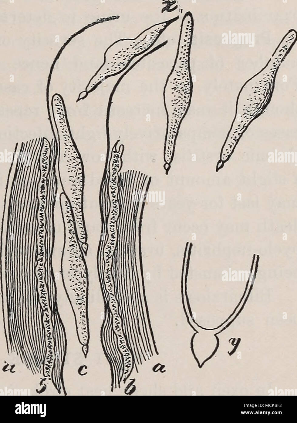 . Abb. 208.- Eier von Rindern Blut Fluke {Schistosoma hovis), Pecu ...