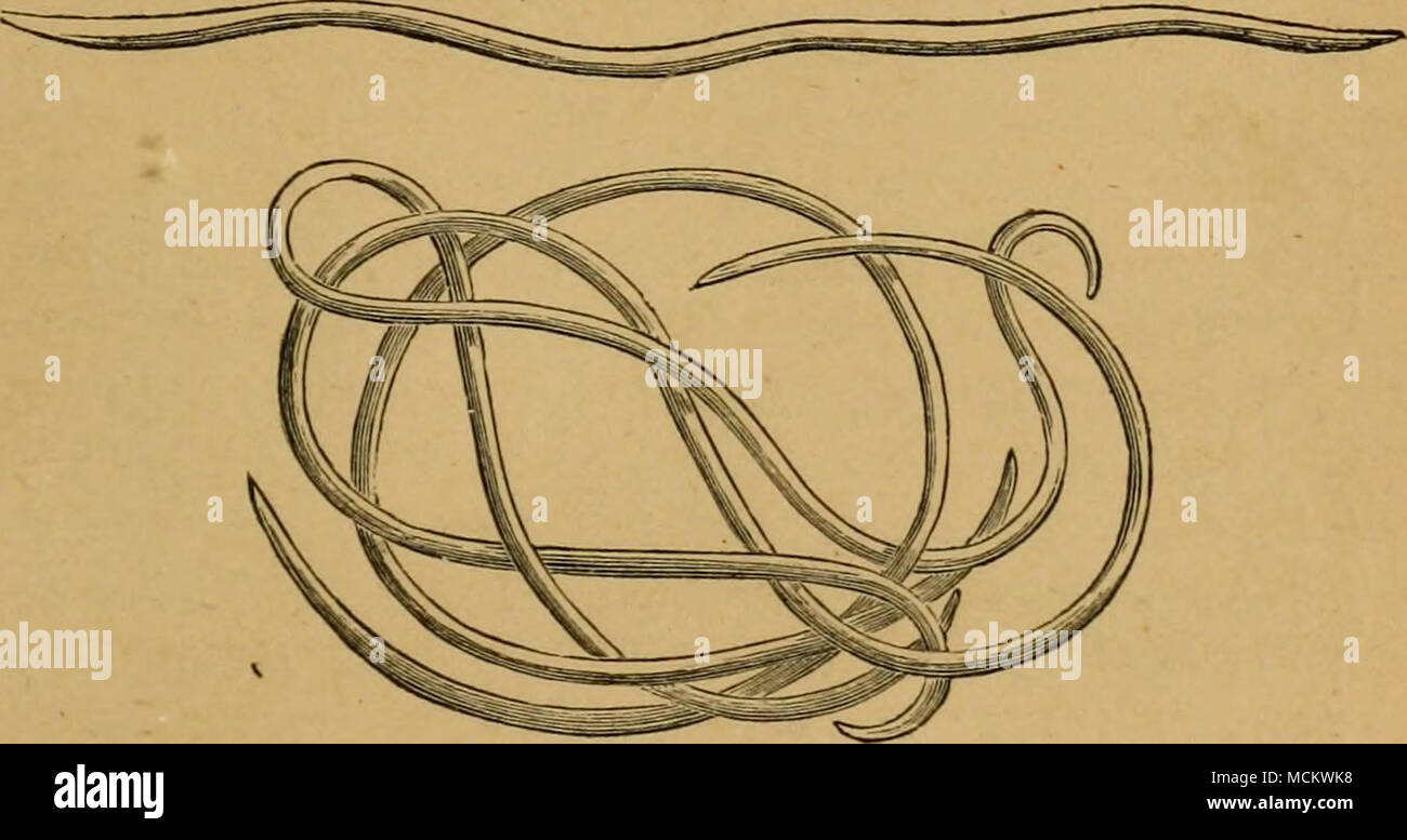 . Abb. 47. - MAW-Worm.Alle sind jetzt gesagt, vom hydatid Formen in der ...