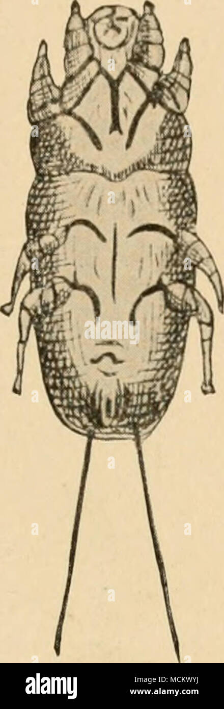 Krätze milben -Fotos und -Bildmaterial in hoher Auflösung – Alamy