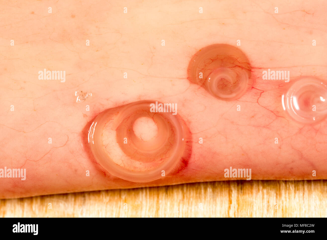 Würmer in fisch -Fotos und -Bildmaterial in hoher Auflösung – Alamy