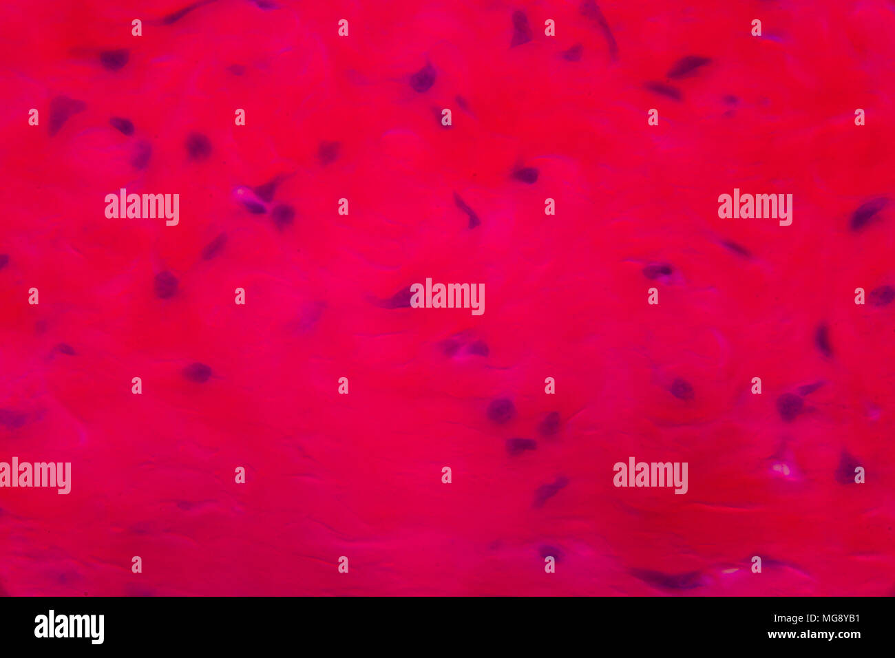 Respiratorisches epithel -Fotos und -Bildmaterial in hoher Auflösung ...