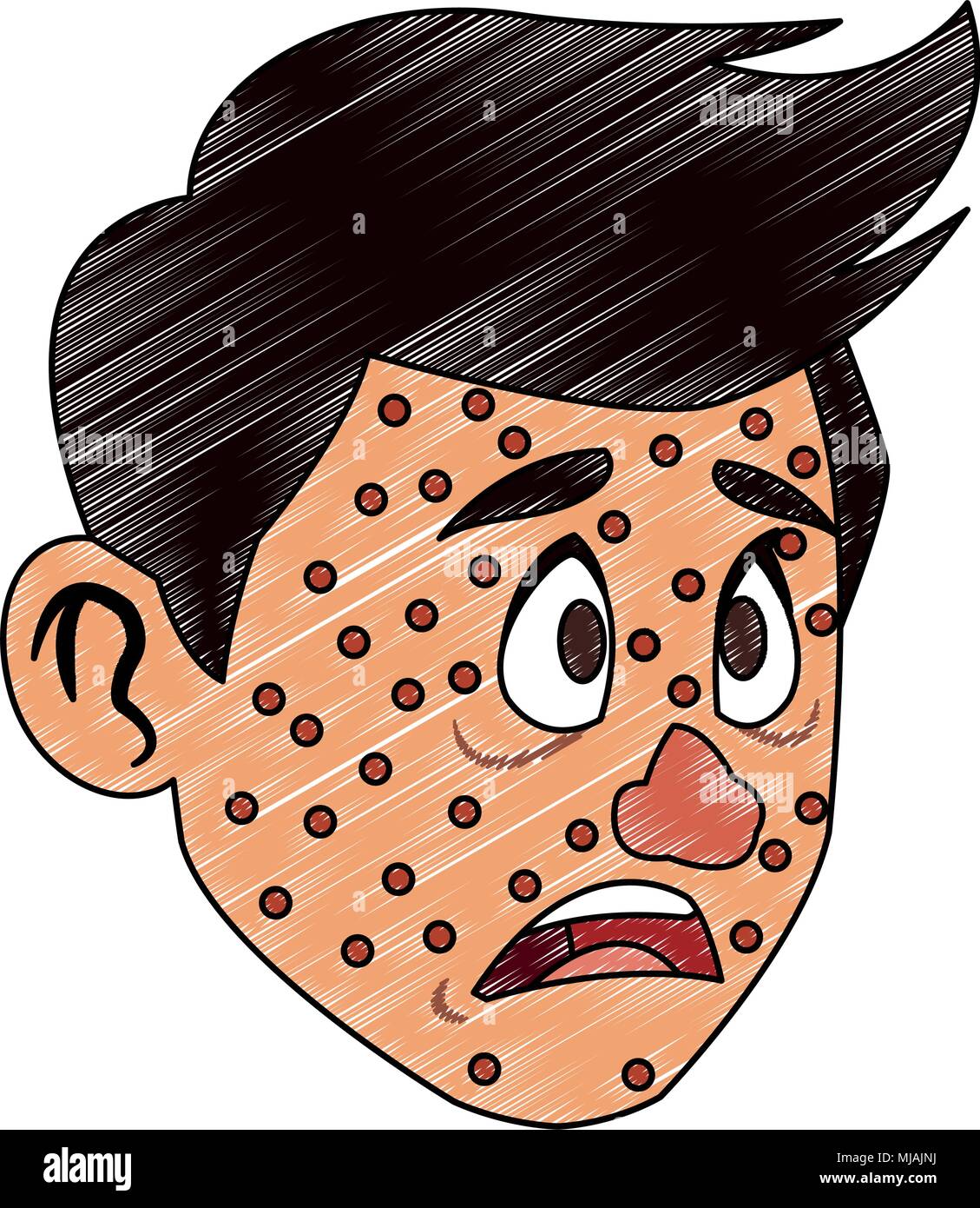 Herpes behandlung Stock-Vektorgrafiken kaufen - Alamy