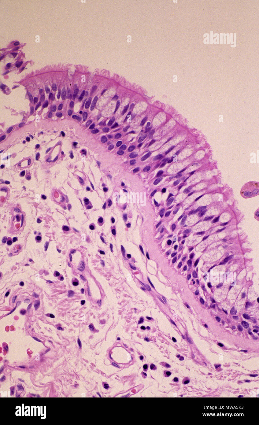 Epithelgewebe der Trachea. Trachealen Epithels Stockfotografie - Alamy