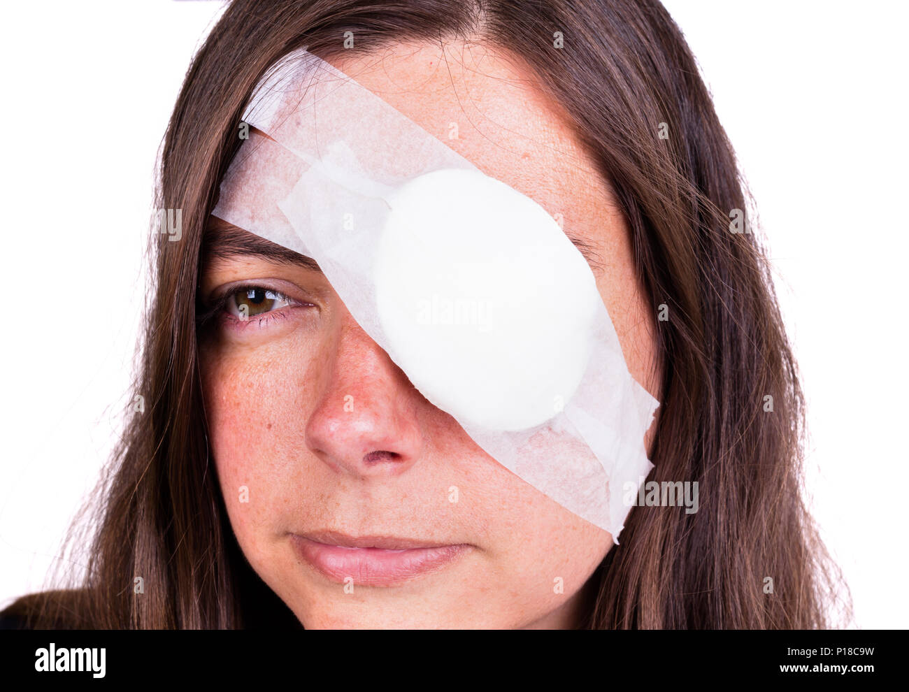 Woman wearing eye patch -Fotos und -Bildmaterial in hoher Auflösung – Alamy