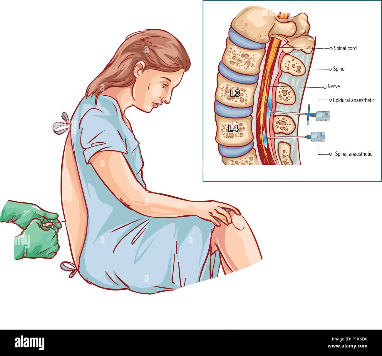Lumbar Vertebra Column Stockfotos & Lumbar Vertebra Column Bilder ...