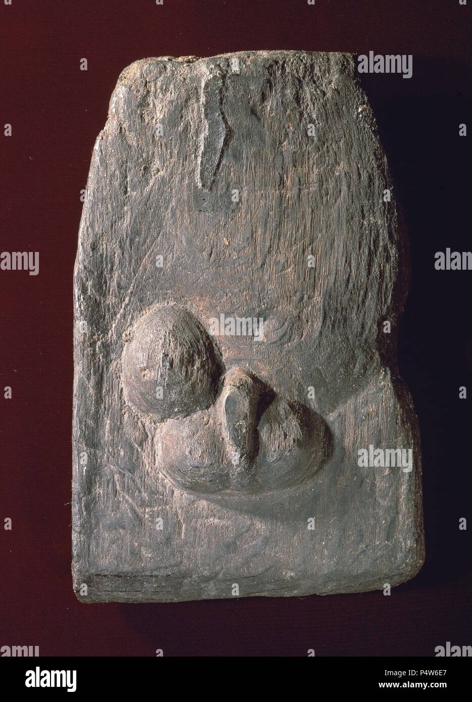 Leistenbruch inguinalhernie -Fotos und -Bildmaterial in hoher Auflösung ...