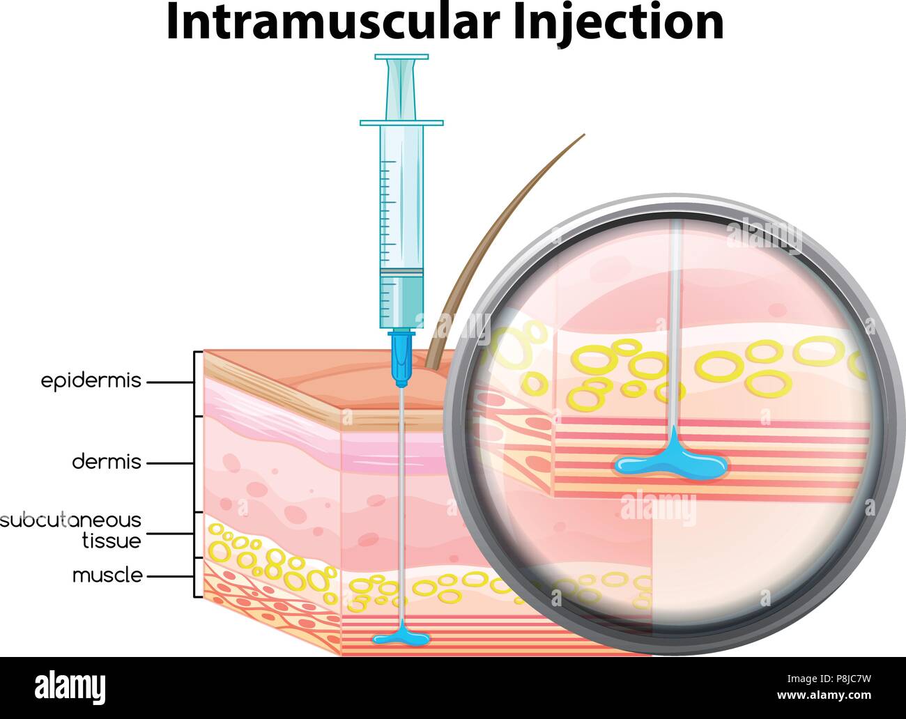 Intramuscular Injection Stockfotos und -bilder Kaufen - Alamy