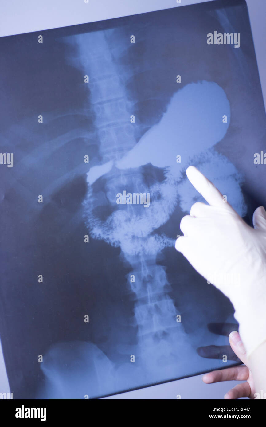 Medizinische Klinik x-ray Lowe Rückenschmerzen Wirbelsäule und Hüfte ...