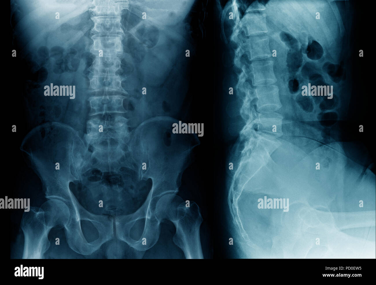 Lumbar curve -Fotos und -Bildmaterial in hoher Auflösung – Alamy