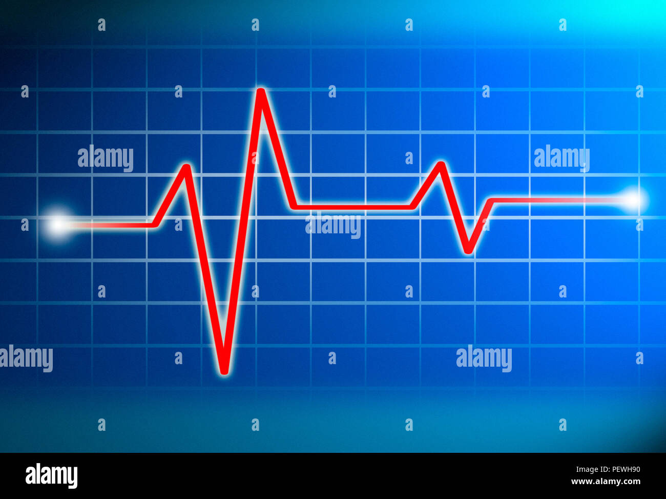 Kardiogramm abbildung -Fotos und -Bildmaterial in hoher Auflösung – Alamy