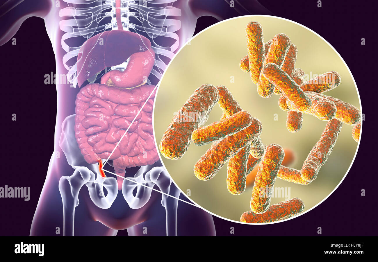 Escherichia coli klebsiella pneumoniae -Fotos und -Bildmaterial in ...