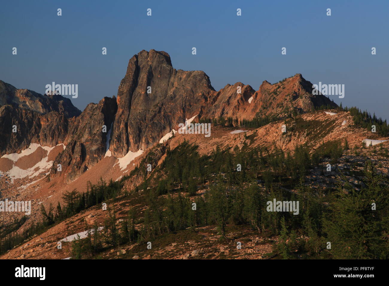 Molar tooth -Fotos und -Bildmaterial in hoher Auflösung – Alamy