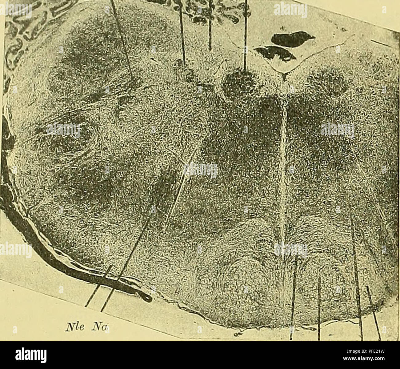 Formatio reticularis -Fotos und -Bildmaterial in hoher Auflösung – Alamy
