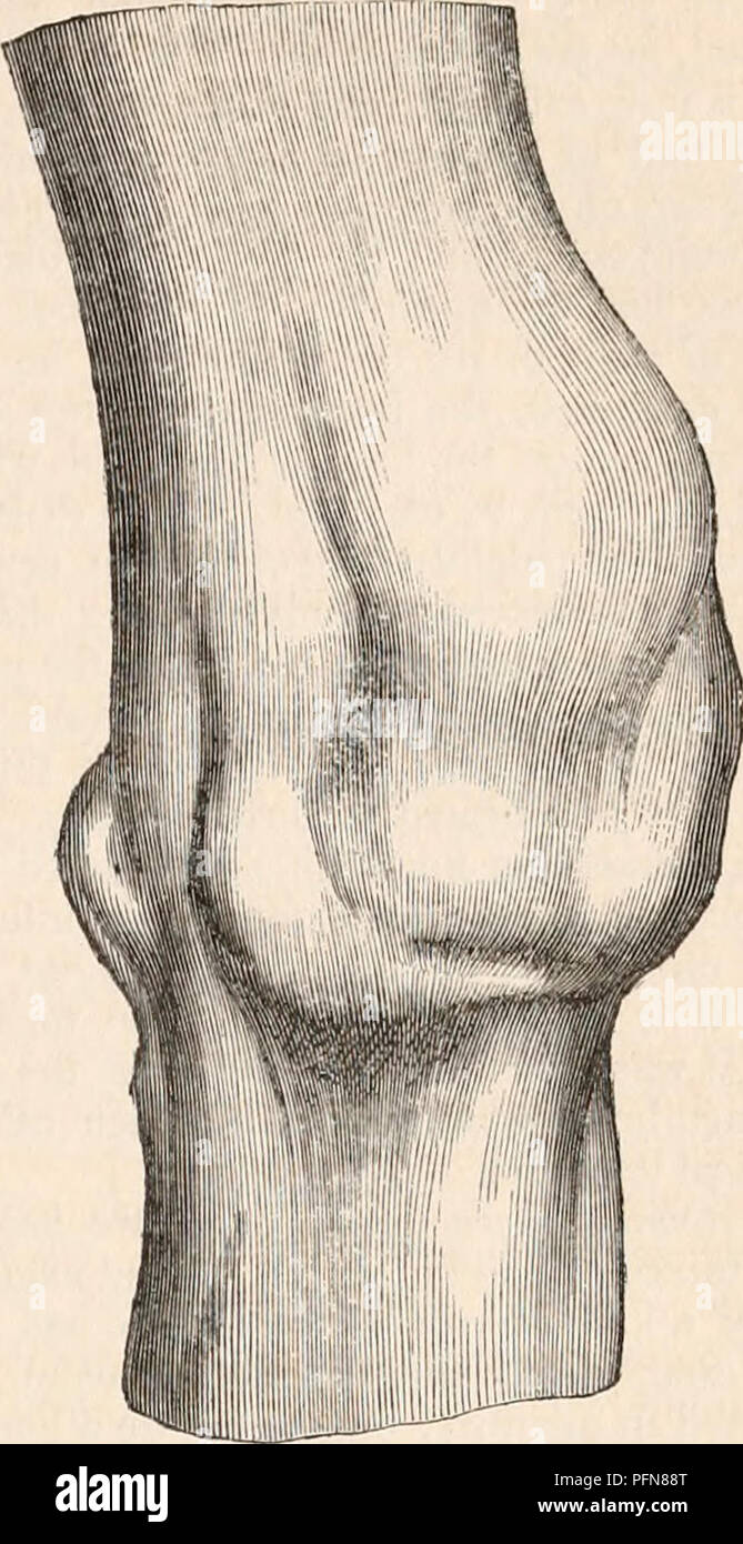 Innerer kondylus -Fotos und -Bildmaterial in hoher Auflösung – Alamy