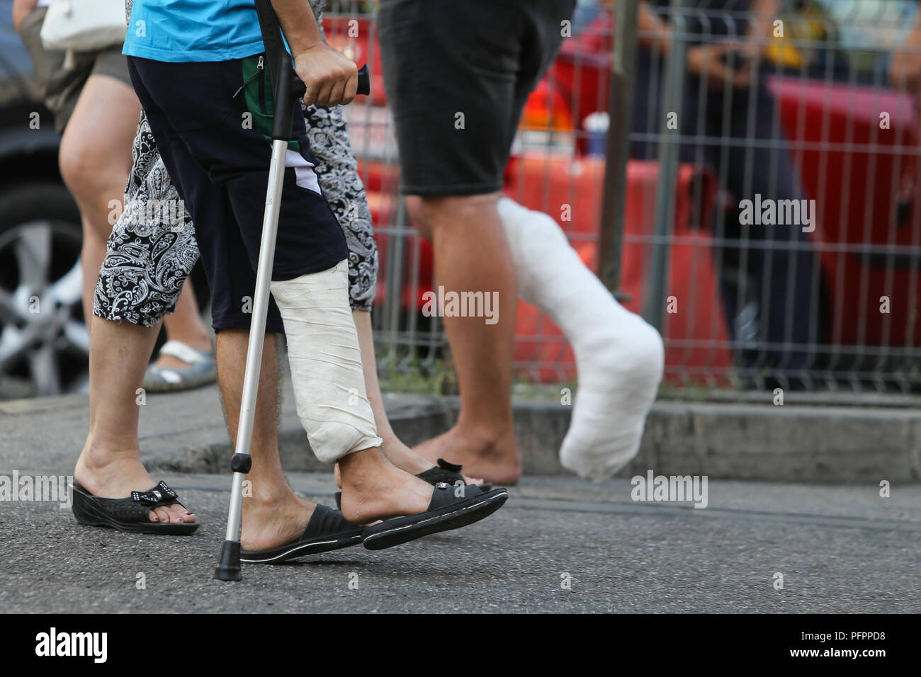 Bein im gipsverband -Fotos und -Bildmaterial in hoher Auflösung – Alamy