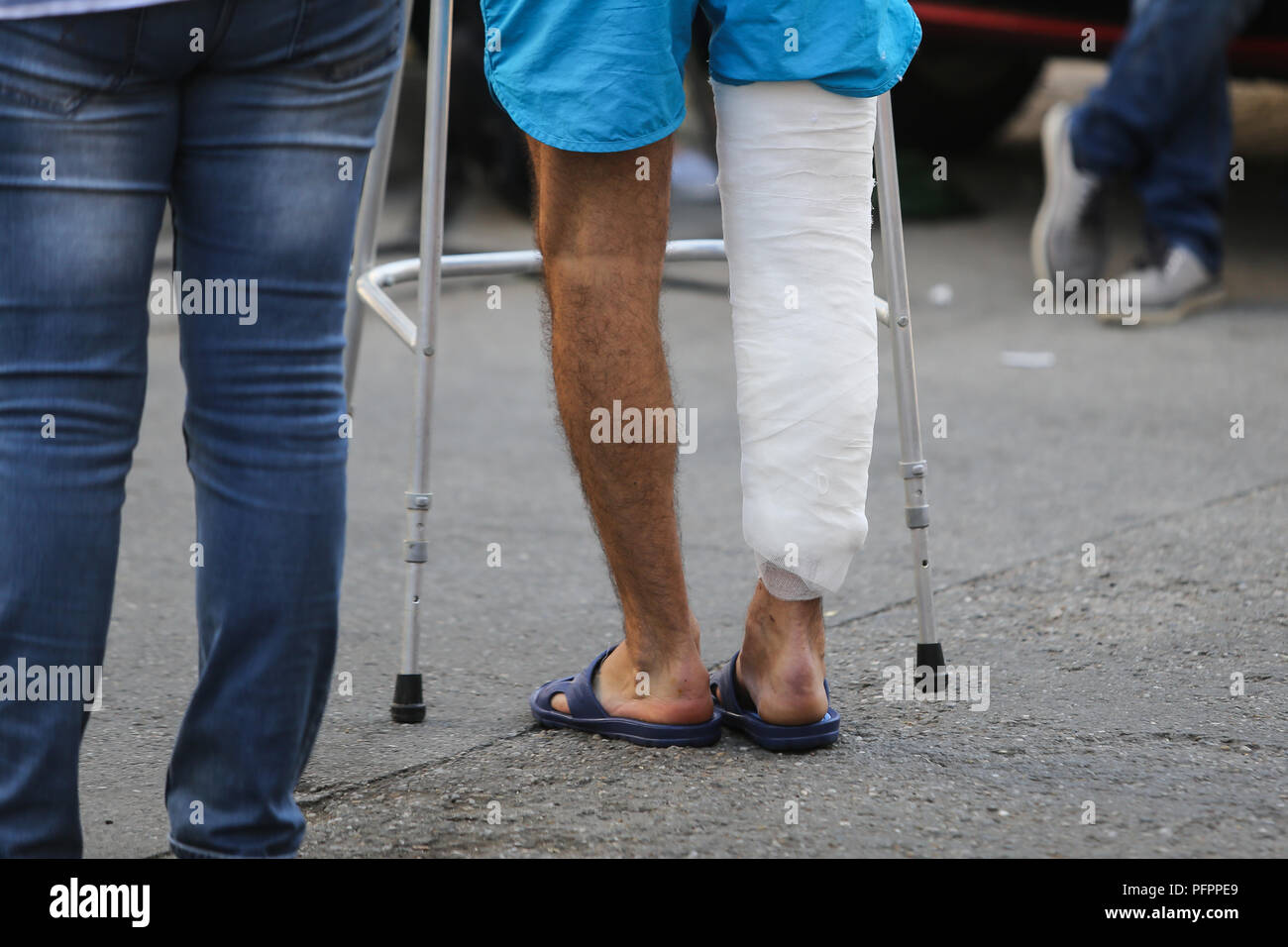 Bein im gipsverband -Fotos und -Bildmaterial in hoher Auflösung – Alamy