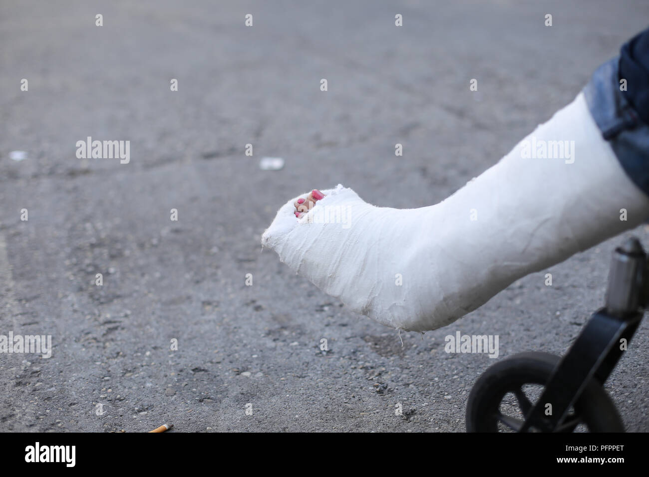 Fuß in gips mann Stockfotos und -bilder Kaufen - Alamy