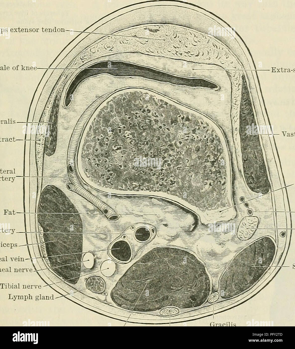 . Cunninghams Lehrbuch der Anatomie. Anatomie. Die Fossa poplitea. 1457 ...