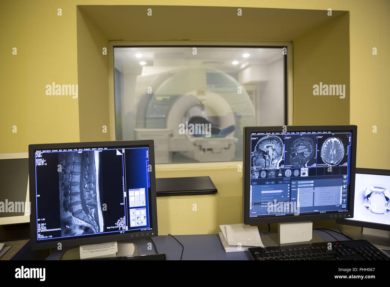 Die Magnetresonanztomographie (MRT) Scan Stockfotografie - Alamy