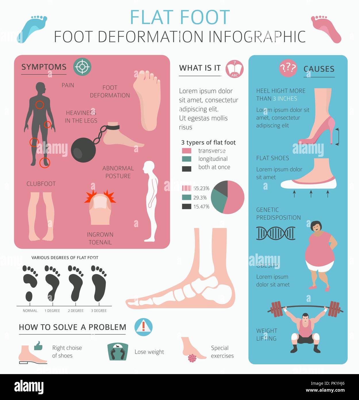 Fuß Verformung als medizinische Krankheit Infografik. Ursachen von Flat ...